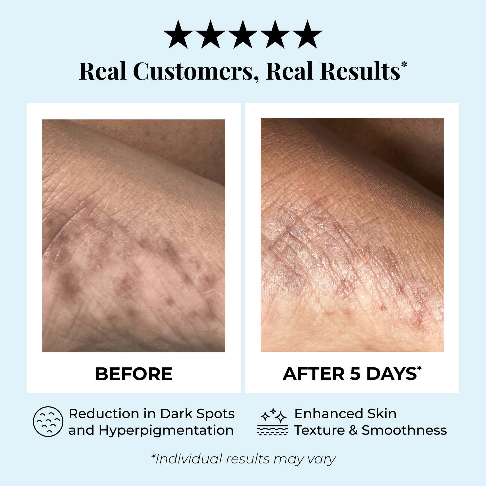 LuxeGlow Tallow Balm — 100% Grass-Fed Moisture Balm for Sensitive Skin ...